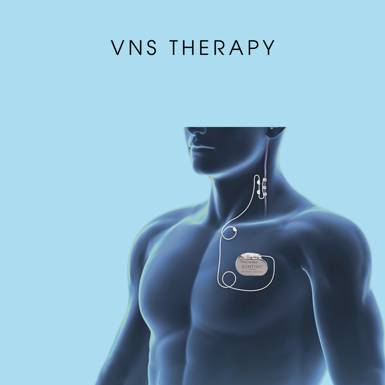 VNS Therapy – ORH Community Support Training Solutions